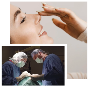 Septal Perforation Repair in Turkey, Istanbul | MD. Duygulu